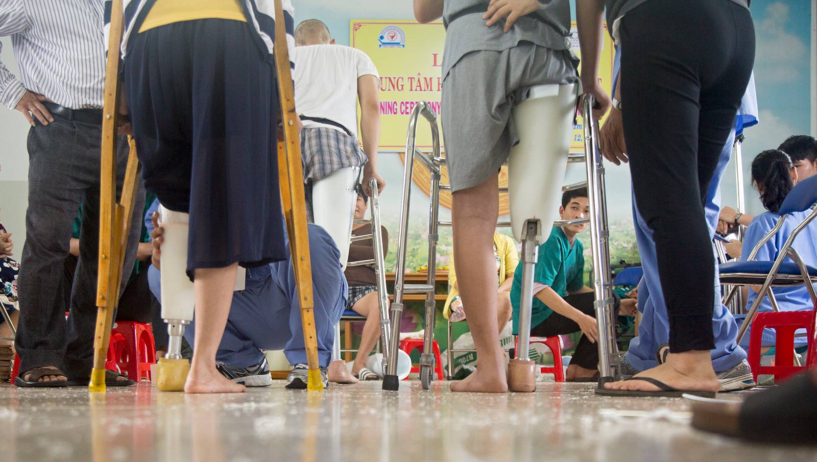 Mercer fits amputees with prosthetic legs in Vietnam